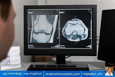 دوره نقاهت عمل تعویض مفصل زانو چقدر است؟ دکتر ابراهیم زاده