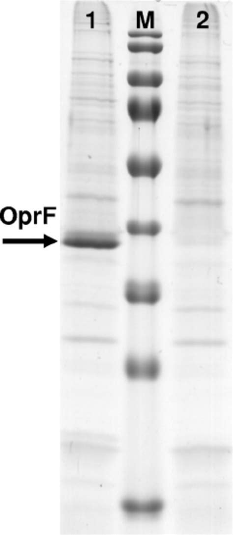 Sds Polyacrylamide Gel Electrophoresis Of Membrane Proteins In