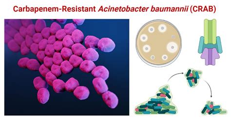 Carbapenem Resistant Acinetobacter Baumannii Crab Overview