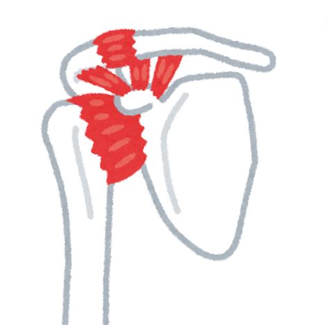 Proximal Biceps Tenodesis Doctors
