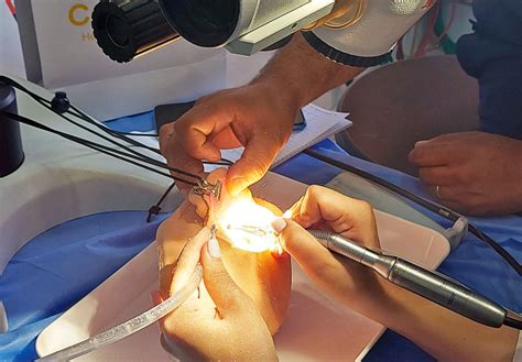 Temporal Bone Dissection Course In Morocco