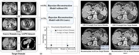 Figure 1 From Unsupervised Domain Adaptation For Low Dose Ct Reconstruction Via Bayesian