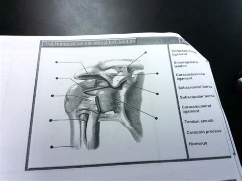 Solved Coracoclavicular Ligament Subscapularis Tendon Coracoclavicular