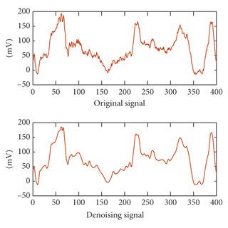 EEG Acquisition Equipment And Filtering Noise Download Scientific Diagram