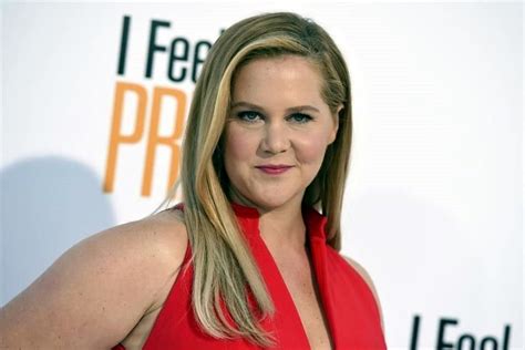 Amy Schumer Revela Que Tiene Síndrome De Cushing