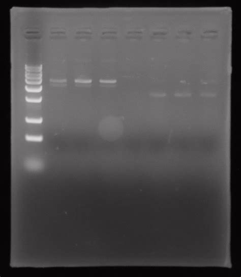 How Temperature Affect Plasmid Dna Conformation Researchgate
