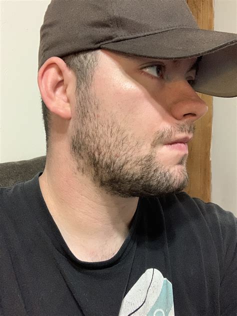 23y O Never Let My Facial Hair Grow For More Than A Week Due Too