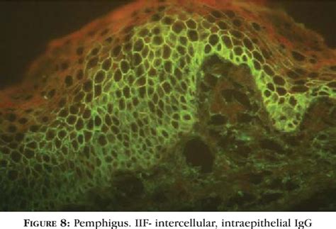 Figure 1 From Direct And Indirect Immunofluorescence Semantic Scholar