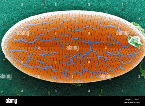 This Digitally Colorized Scanning Electron Micrograph Sem Untreated