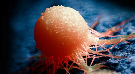 Luveltamab Tazevibulin Provides Significant Clinical Benefit For