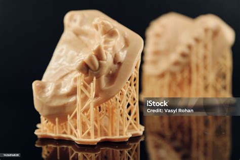 3d 프린팅 치과 크라운 및 브리지 모델 치과 교정 모델 0명에 대한 스톡 사진 및 기타 이미지 0명 3차원 형태 Stem 주제 Istock