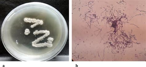 Growth And Colony Morphology Of Actinomycetes Isolate Lep 7 Aisolate