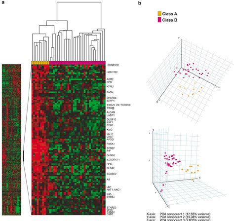Molecular Subclasses Of Er À Pr À Breast Cancers A Two Way