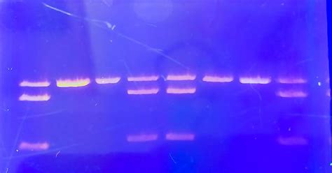 Etbr Gel Album On Imgur