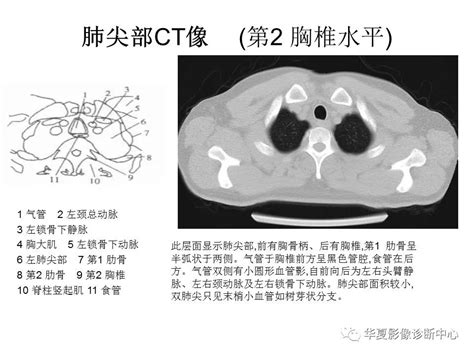 胸部ct基本读片知识概述 医学界 助力医生临床决策和职业成长