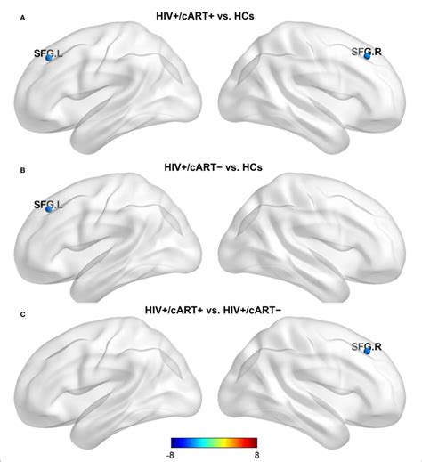 Figure Between Group Results In Regional Nodal Metrics Nlp The Color