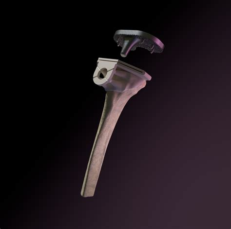 custom surgical guide using ntop