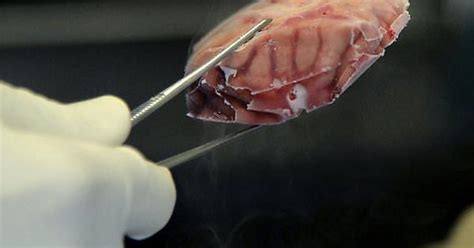 Lab Grown Organs “go Rogue” Sprout Brains And Muscles Album On Imgur