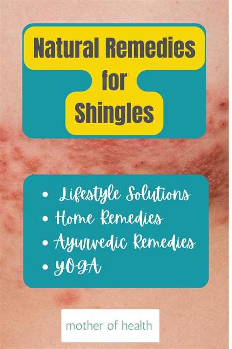 Natural Remedies For Shingles Mother Of Health
