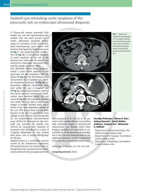 Pdf Hydatid Cyst Mimicking Cystic Neoplasm Of The Pancreatic Tail An