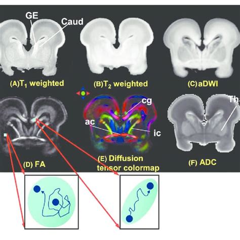 Diagrams Of Simplified Diffusion Sequence A Diffusion Weighted Image