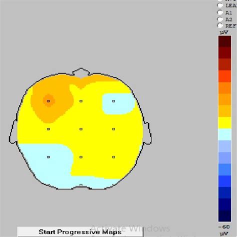 Visual Stimulus Single Map Download Scientific Diagram