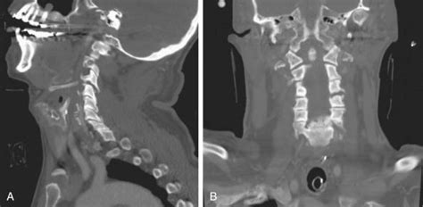 Traumatic Arterial Injuries Diagnosis And Management Clinical Tree
