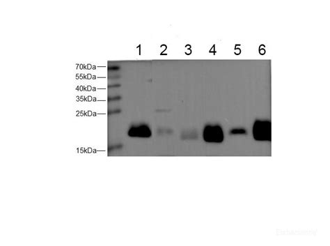 High Affinity And Specificity Ferritin Heavy Polyclonal Antibody E Ab