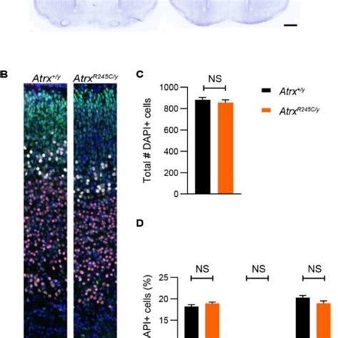 Embryonic Cortical Development Is Unaffected In Atrx R245cy Mice