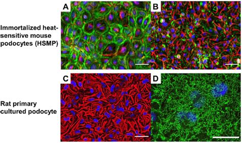 Interdigitating The Foot Process Formation With Cultured Podocytes A