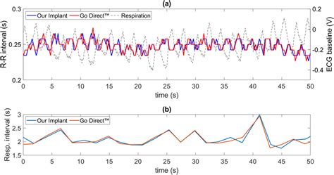 a r r intervals extracted using the clean ecg signals from both the