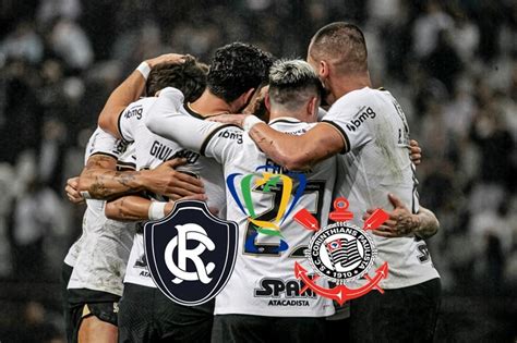 Remo X Corinthians Vai Passar Na Globo Onde Assistir Ao Vivo E Online