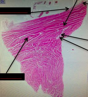 Intramembranous Ossification Flashcards Quizlet