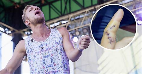 Joshua Nolet Op Vakantie Gewond Hele Trap Onder Het Bloed Gossip