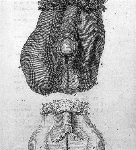 ‘neither And Yet Both ‘hermaphroditism And Binaries