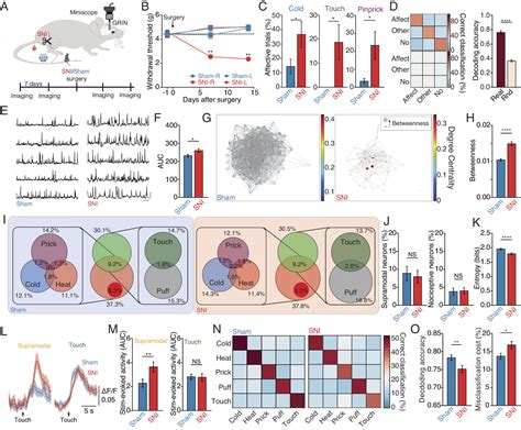 Principles Of Nociceptive Coding In The Anterior Cingulate Cortex Pnas