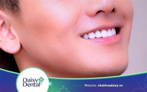 Tìm Hiểu Về Răng đẹp Nam Và 6 Tiêu Chí đánh Giá Một Chiếc Răng đẹp
