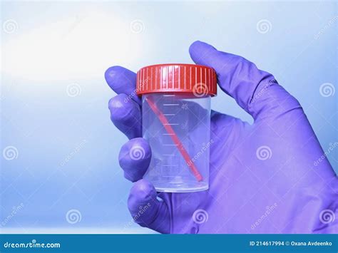 A Container For Biomaterials With Sperm Analysis And A Red Lid On A