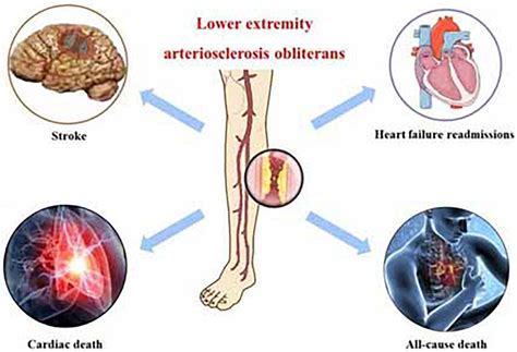 Frontiers Novel Insight Into Long Term Risk Of Major Adverse