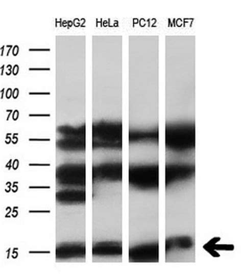 Synj2bp Mouse Anti Human Clone Oti3a9 Truemab Origene 30 μl
