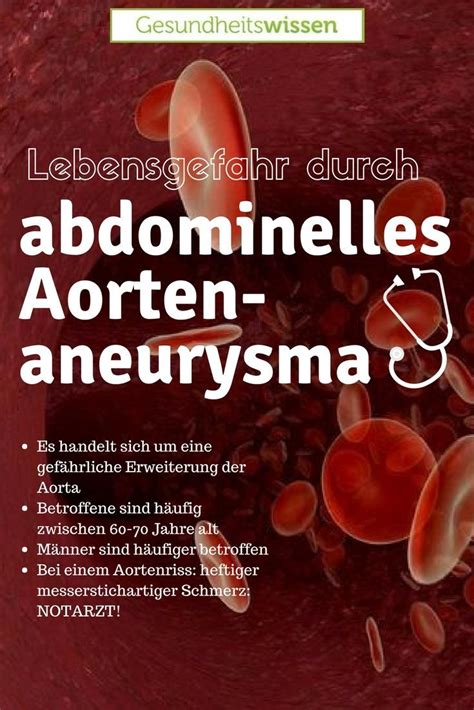 Ein So Genanntes Abdominelles Aortenaneurysma Ist Eine Gefährliche