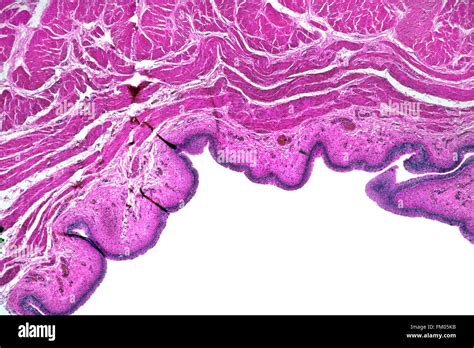 Bladder Stained Section Brightfield Photomicrograph Showing