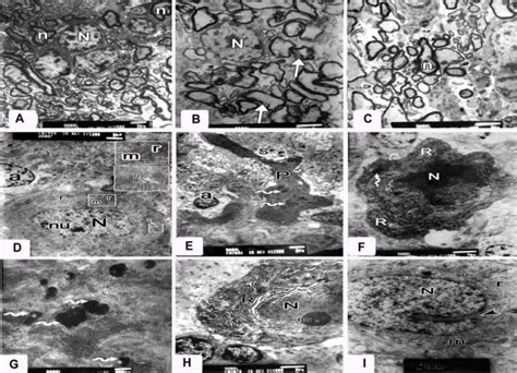 Electron Micrograph Of The Molecular Layer From Cerebellar Cortex Of Download Scientific