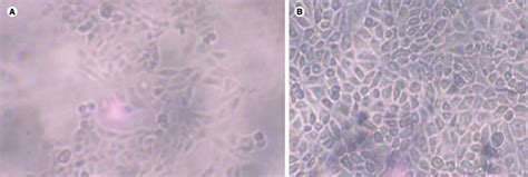Healthy Deuterated Vero Cells A Deuterated Vero Cells In The Initial