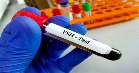 What Is A Normal Fsh Level To Get Pregnant Dr Mona Dahiya