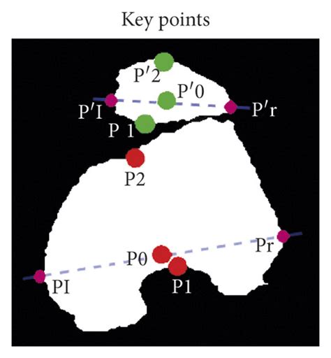 Key Points Pta And Pls As Shown In A Each Bone Has Three Key