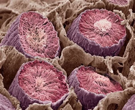 Understanding Testicular Sperm Extraction Tese And Microtese