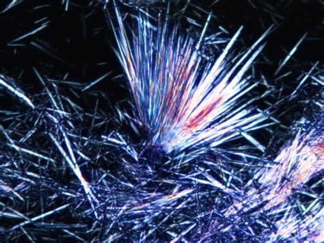 Acid Under A Microscope At Richard Peay Blog