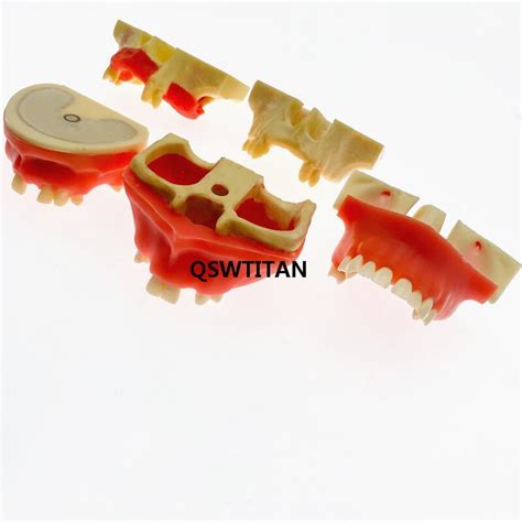 Dental Model Sinus Lift Practice Teeth Model Typod Vicedeal