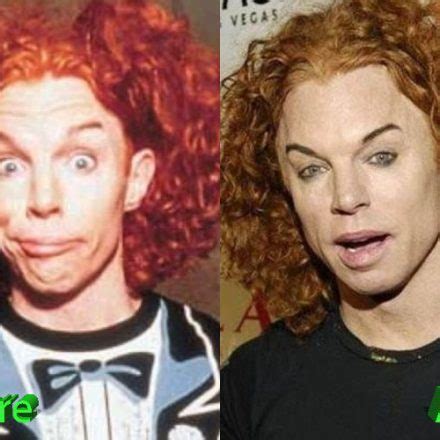 Carrot Top Plastic Surgery Not So Funny Anymore